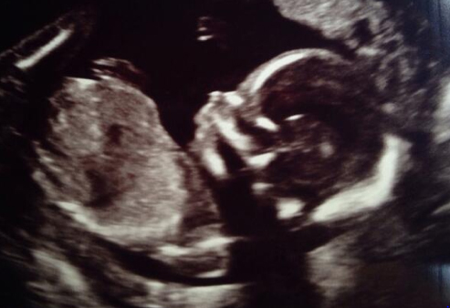 Singer shares a snap of her first baby scan