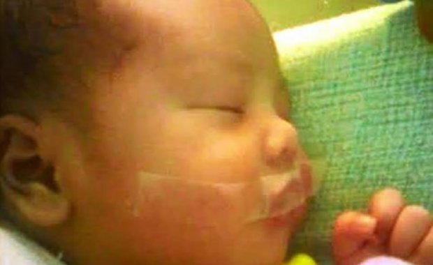 Outrage as baby gagged with tape to stop him from crying