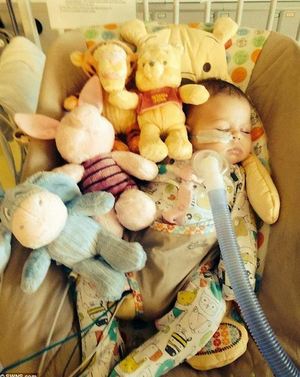 Baby made completely mute after lifesaving operation