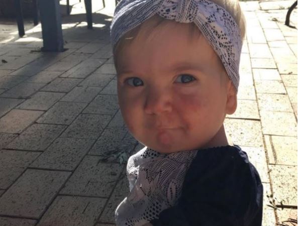 A fighter! Real life 'Thumbelina' beats all odds to celebrate...